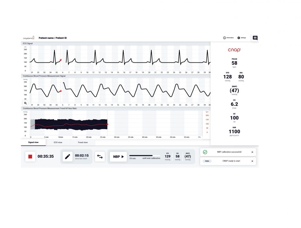 APC Cardiovascular | Task Force® Touch CARDIO